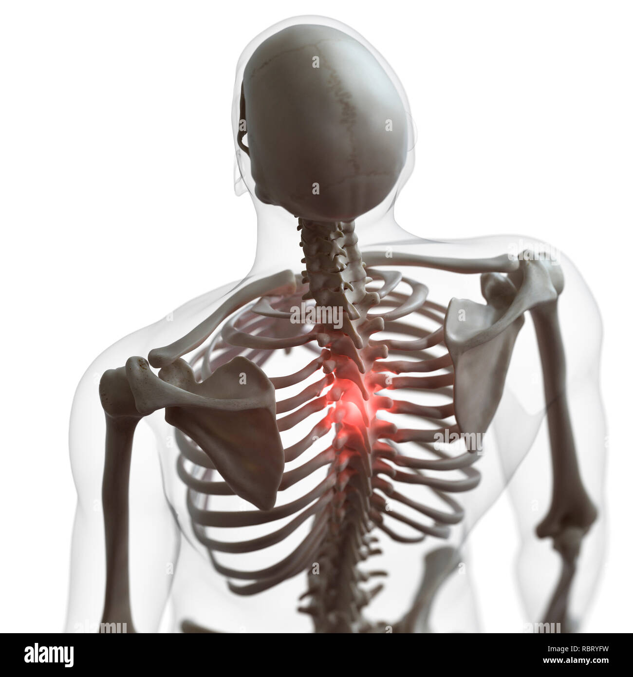 Illustration of a painful back Stock Photo - Alamy