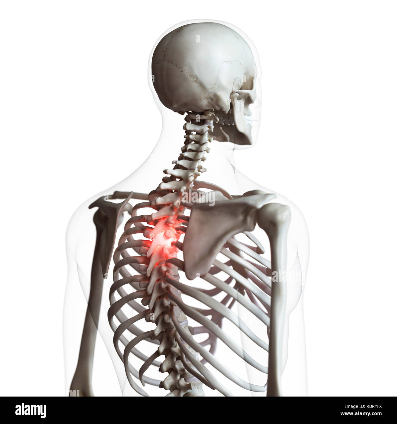 Illustration of a painful back Stock Photo - Alamy