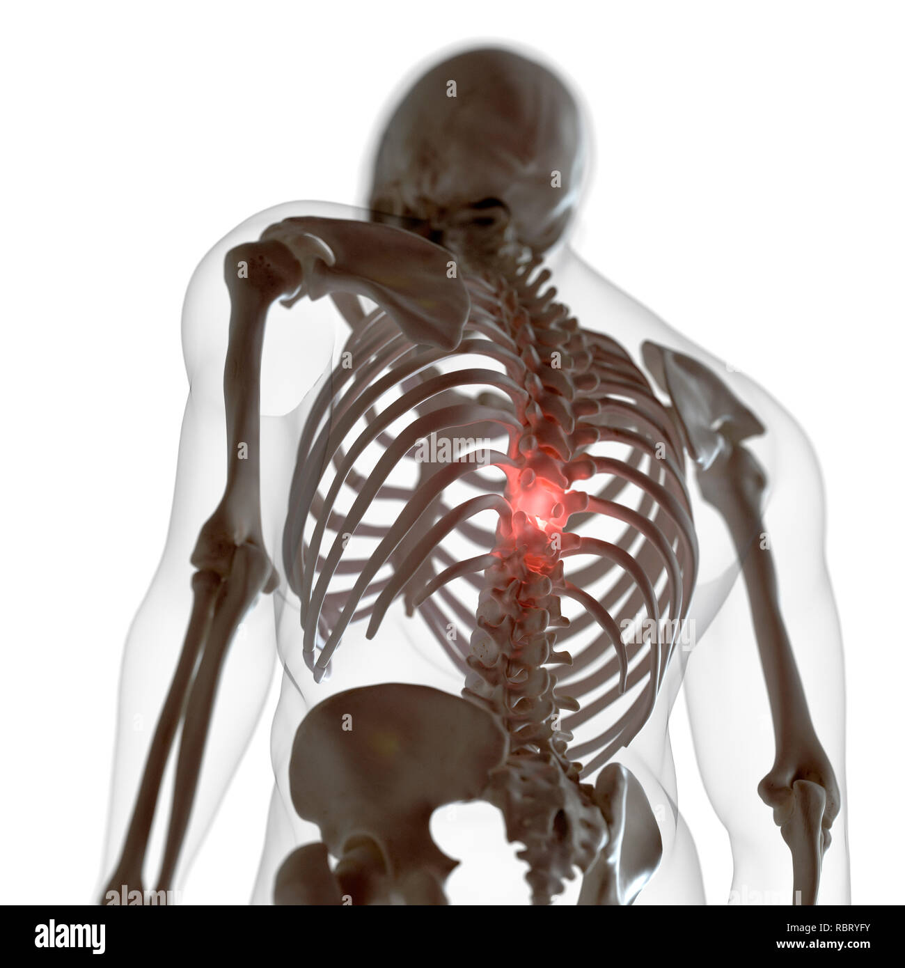 Illustration of a painful back Stock Photo - Alamy