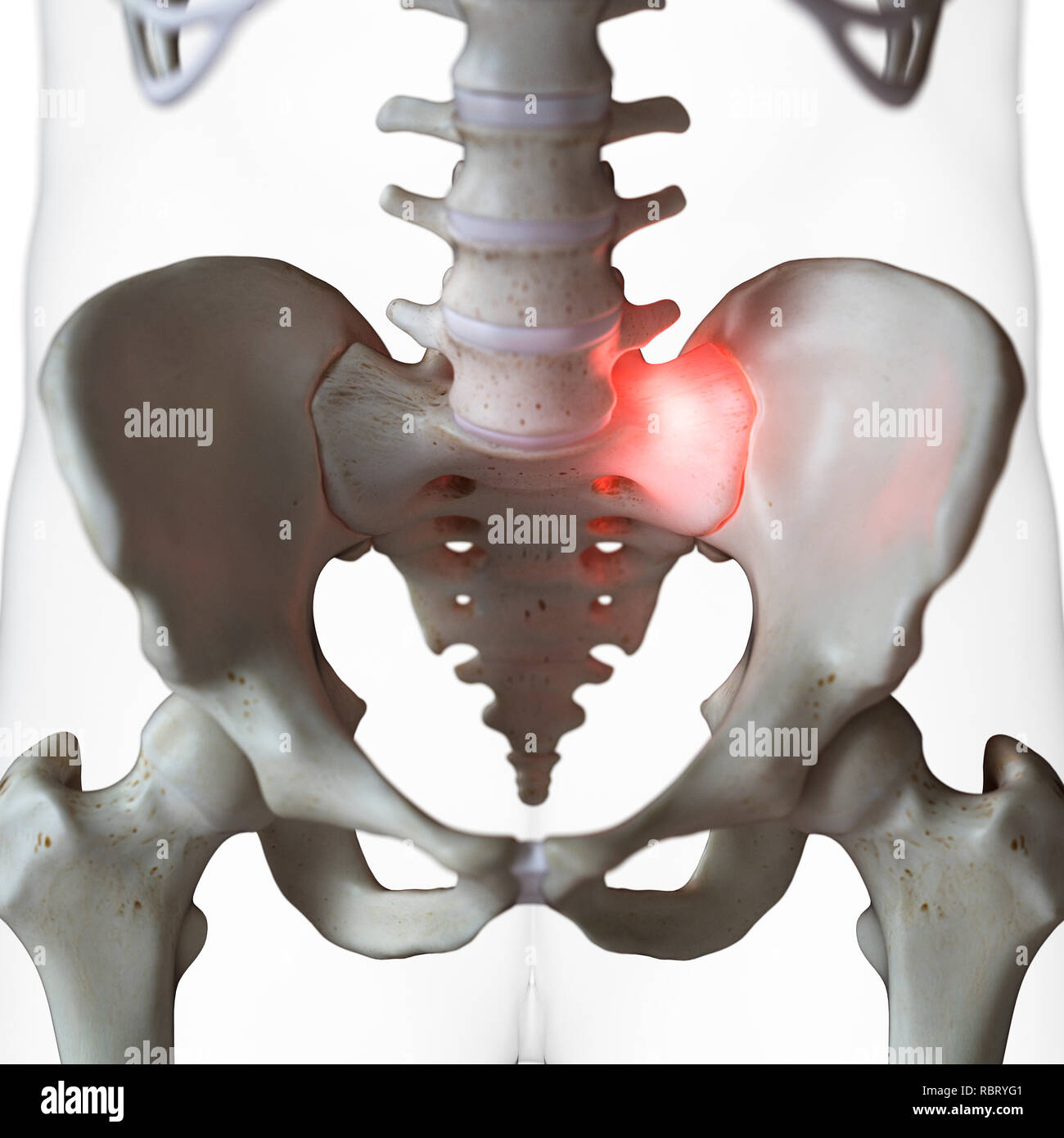 Illustration of a painful sacrum joint Stock Photo - Alamy