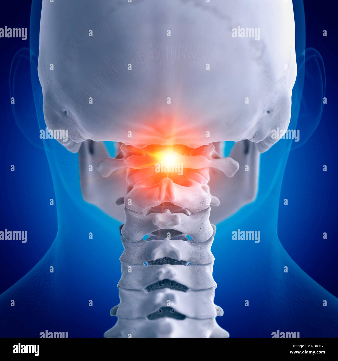 Atlas vertebrae hi-res stock photography and images - Alamy