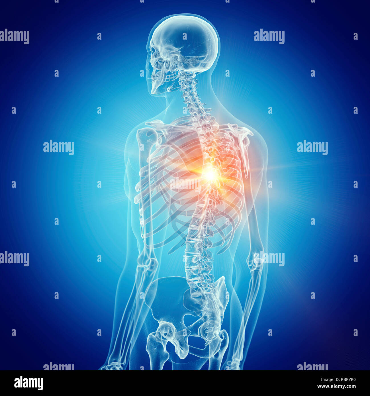Illustration of a painful back Stock Photo - Alamy