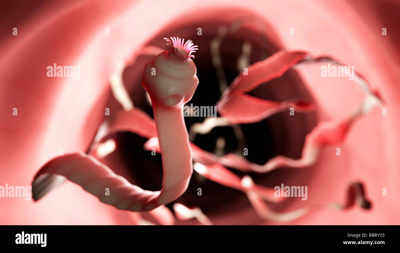 Illustration of a tapeworm Stock Photo - Alamy