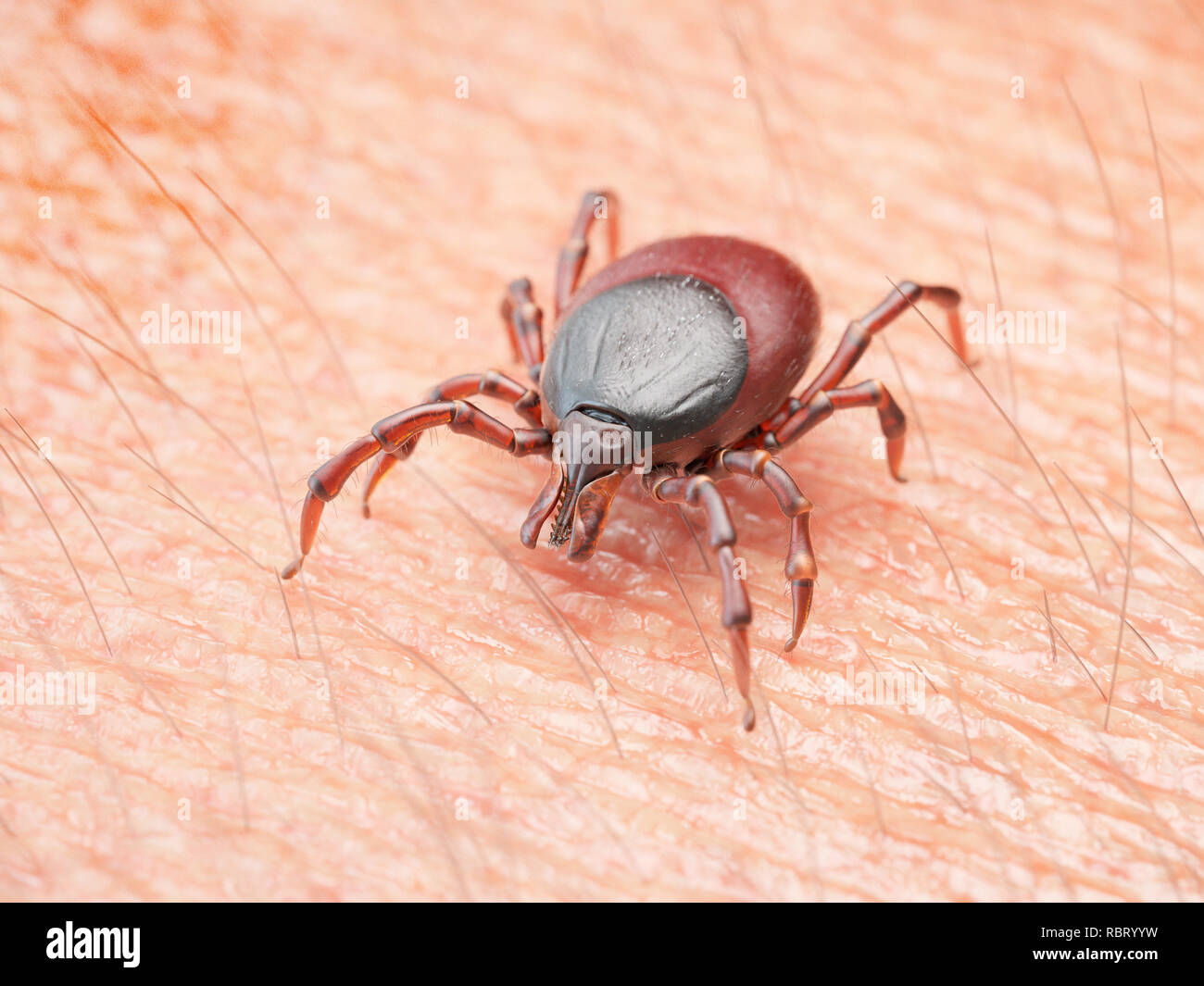 Illustration of a tick crawling on human skin Stock Photo - Alamy