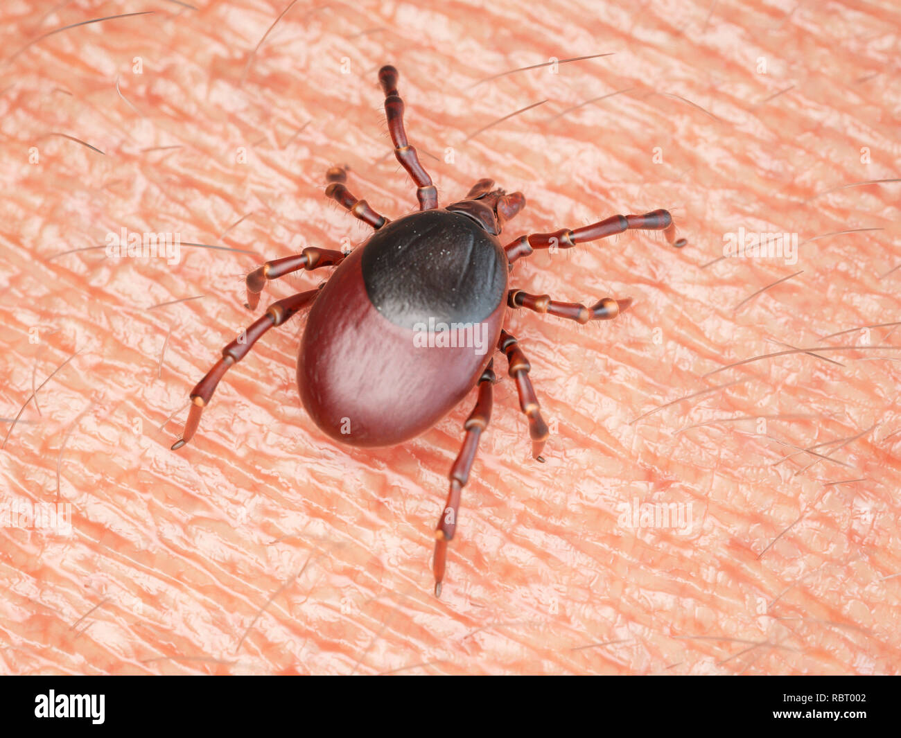 Illustration of a tick crawling on human skin Stock Photo - Alamy