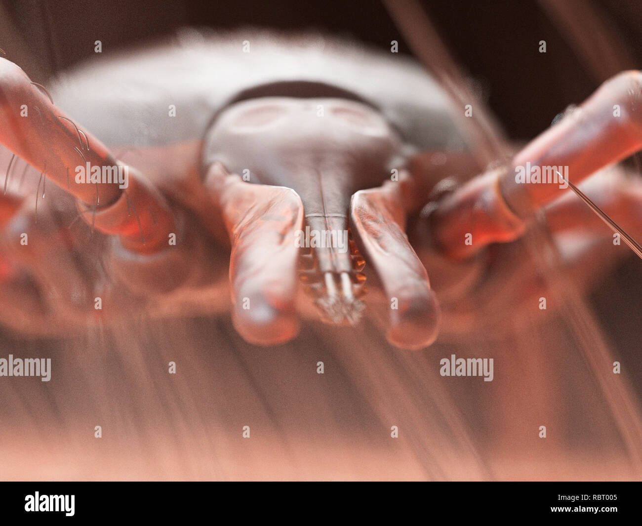 Illustration of a tick crawling on human skin Stock Photo - Alamy