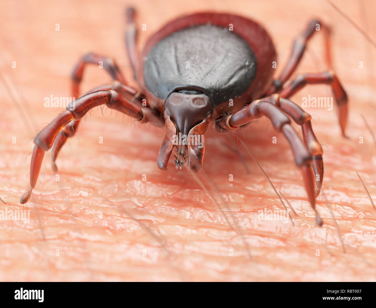 Illustration of a tick crawling on human skin Stock Photo - Alamy
