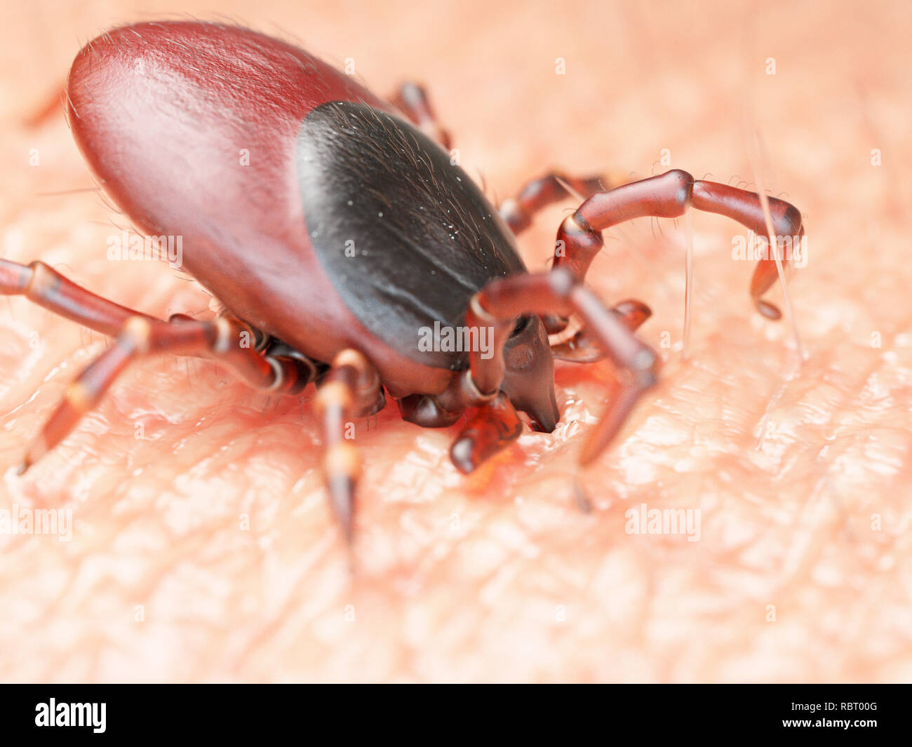 Illustration of a tick biting human skin Stock Photo - Alamy