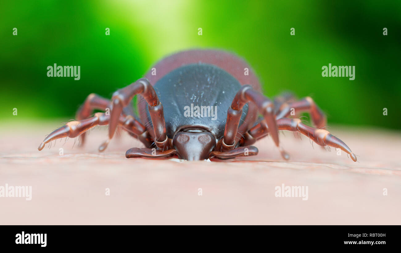 Illustration of a tick biting Stock Photo - Alamy