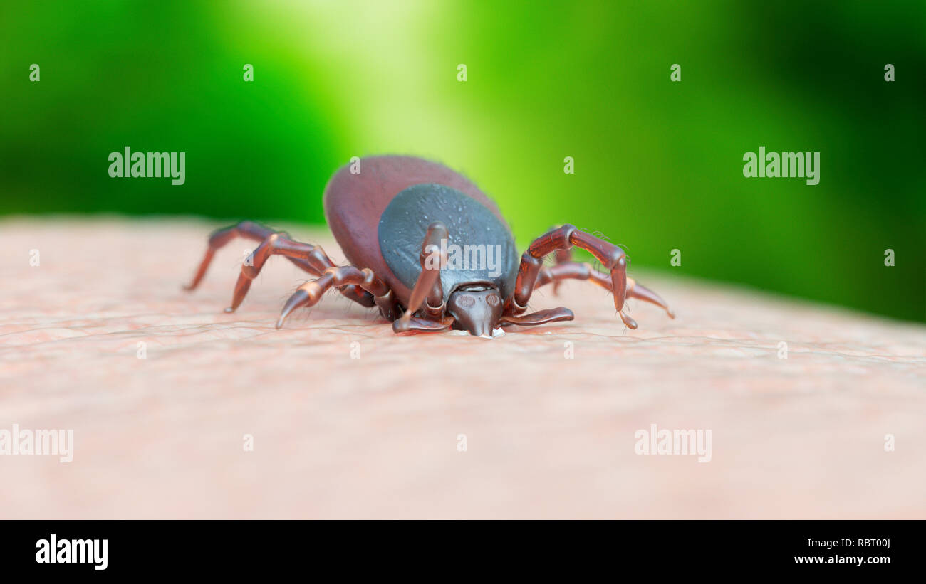 Illustration of a tick biting Stock Photo - Alamy