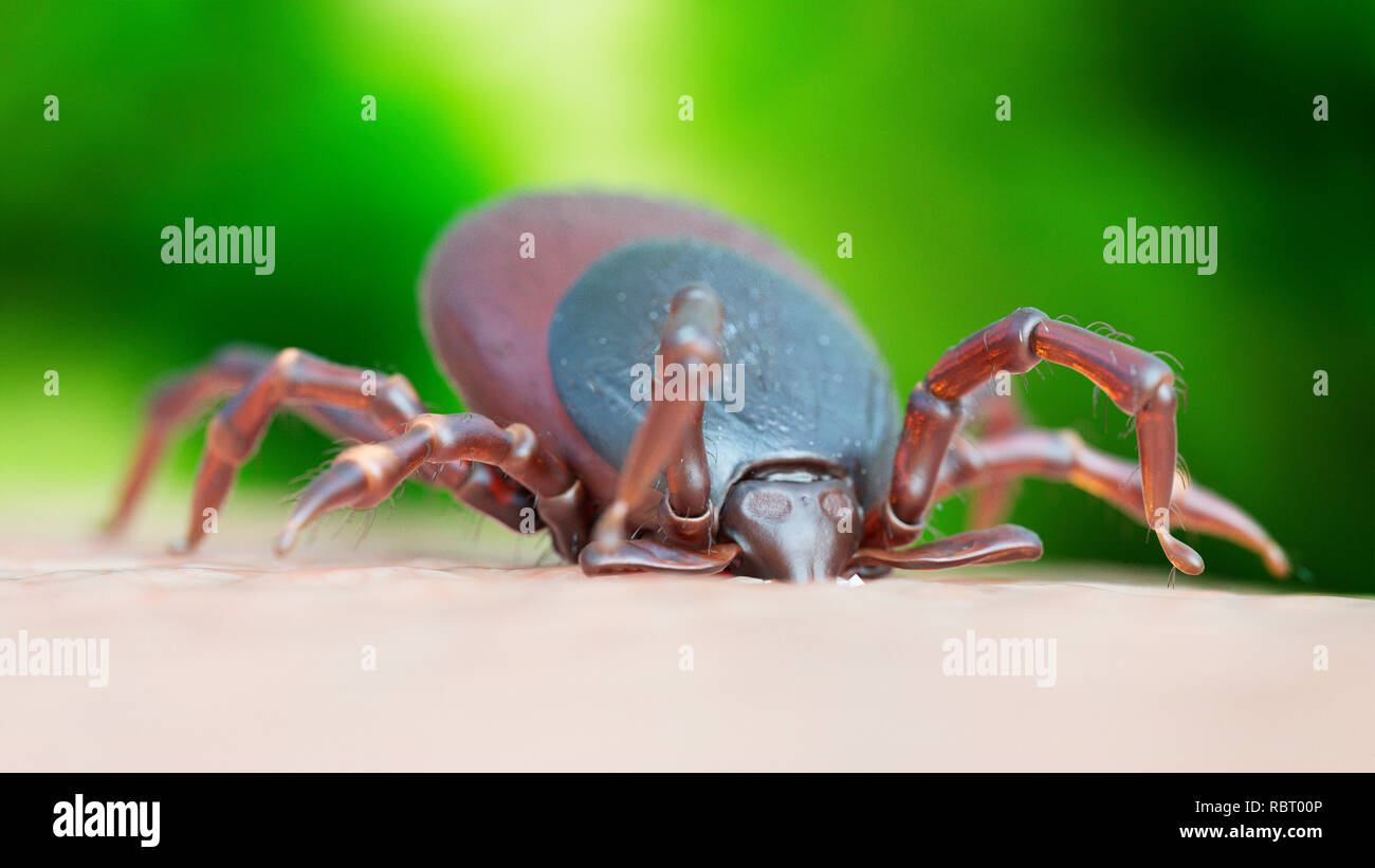 Illustration of a tick biting Stock Photo - Alamy