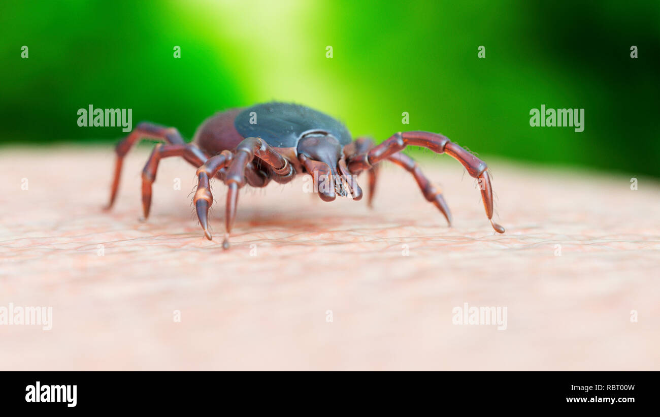 Illustration of a tick crawling on human skin Stock Photo - Alamy