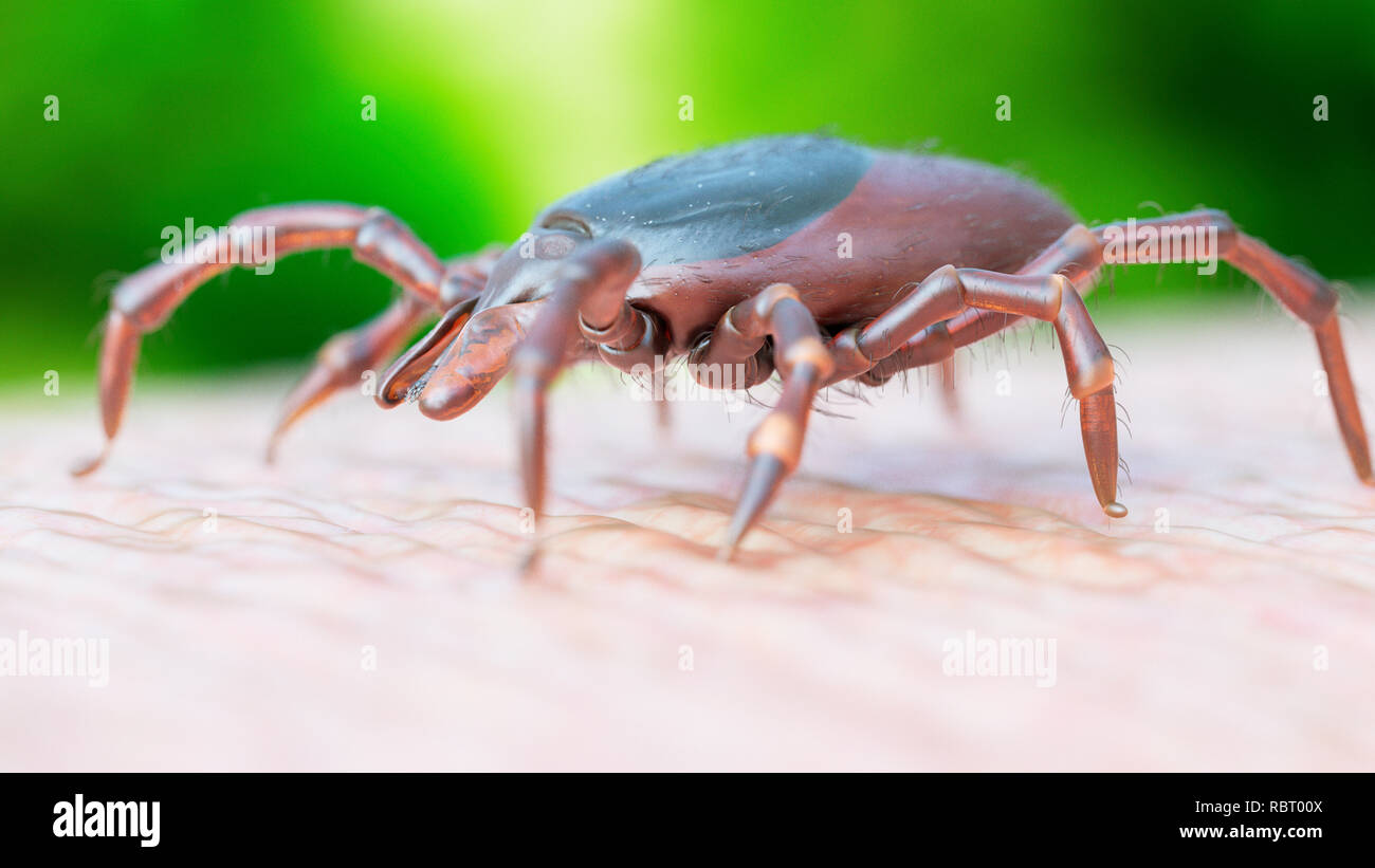 Illustration of a tick crawling on human skin Stock Photo - Alamy