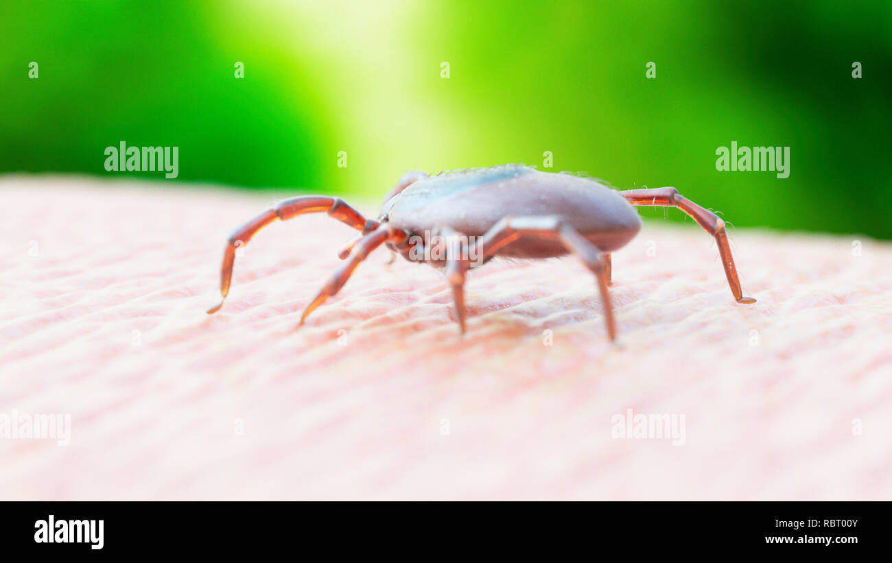 Illustration of a tick crawling on human skin Stock Photo - Alamy