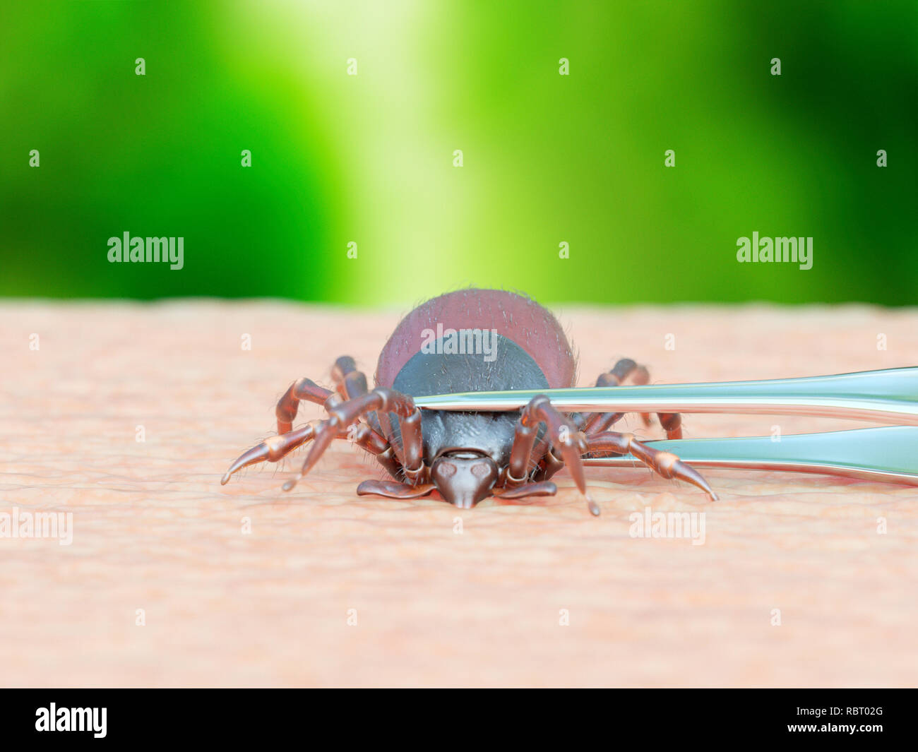 Tick removal hook hi-res stock photography and images - Alamy