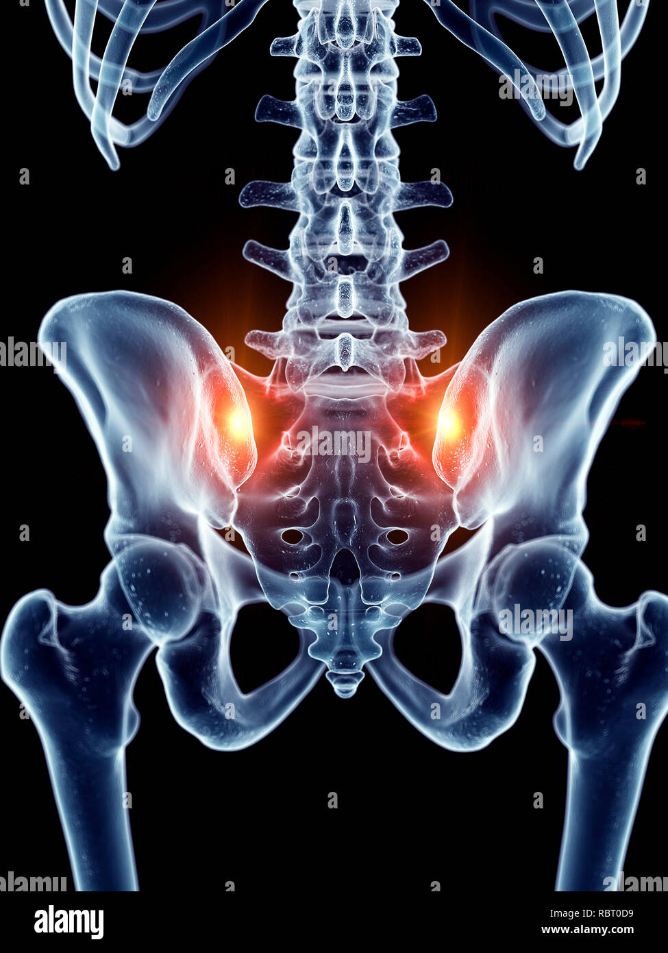 Illustration of painful sacrum joints Stock Photo - Alamy