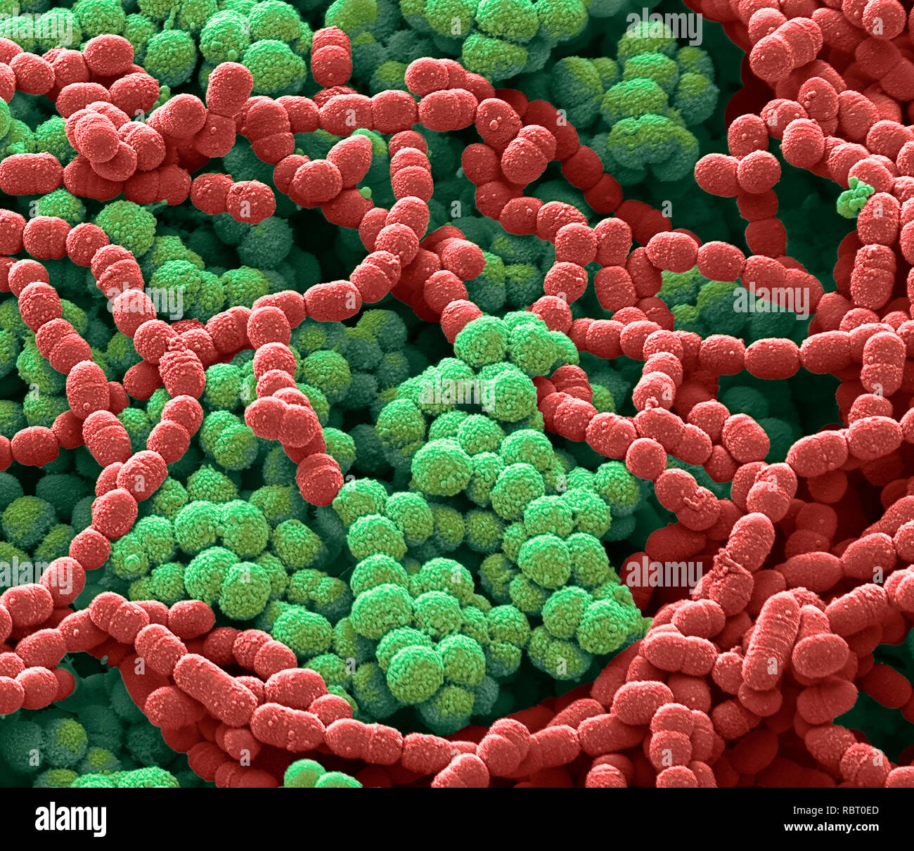 Mycobacterium Tuberculosis Microscope Stock Photos & Mycobacterium ...