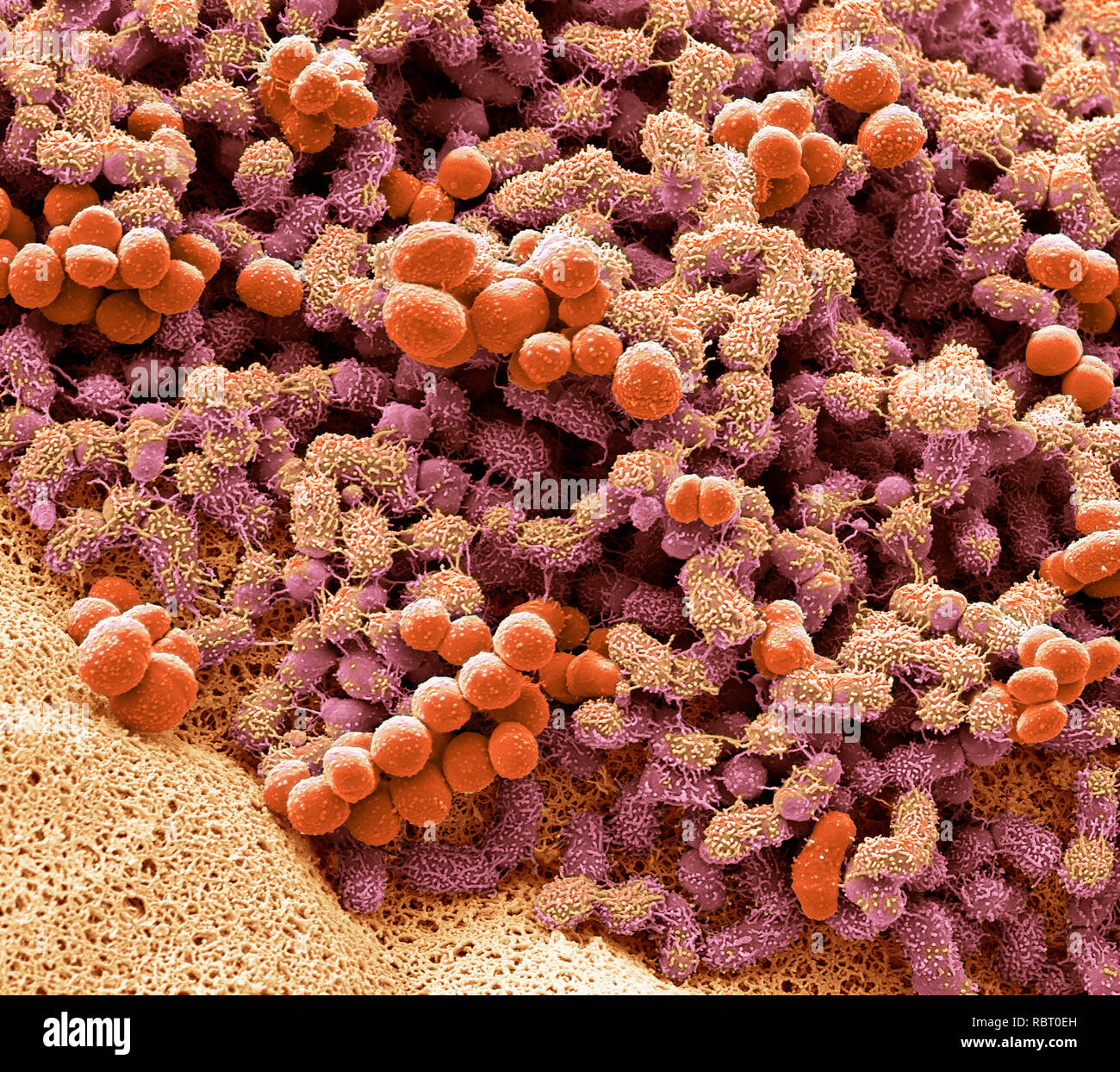 Foot bacteria. Scanning electron micrograph (SEM) of bacteria that live ...