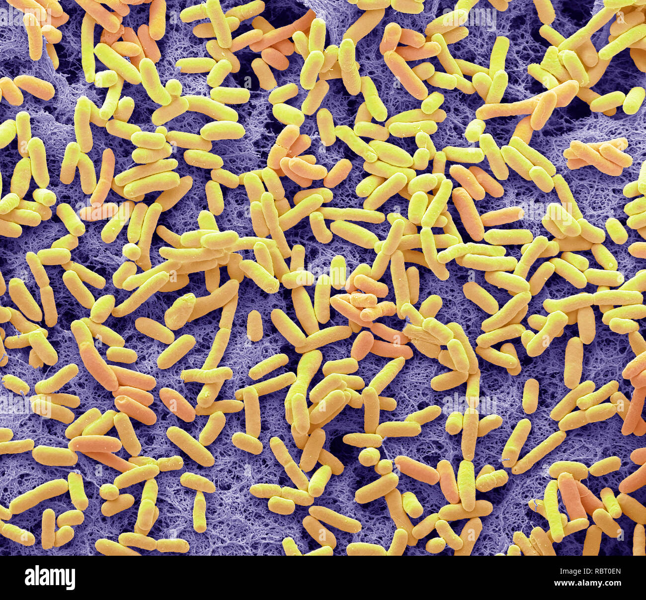 E.coli bacteria. Coloured scanning electron micrograph of the rod ... E.coli bacteria. Coloured scanning electron micrograph of the rod ...
