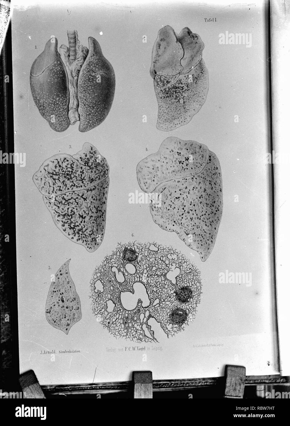 Organen hi-res stock photography and images - Alamy
