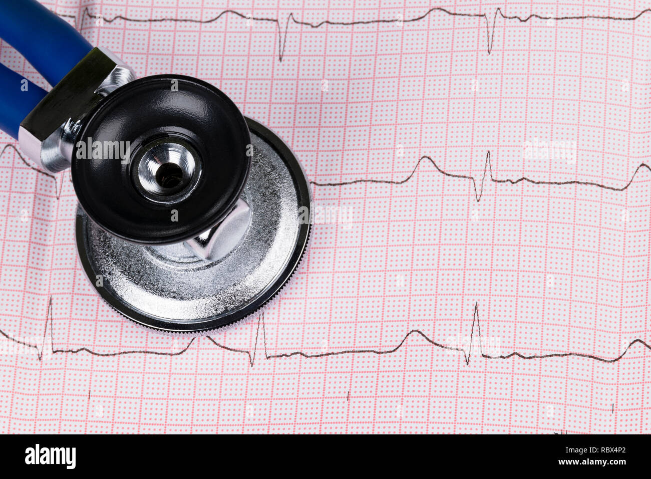 Stethoscope on the electrocardiogram (ECG) graph.Medicine concept ...