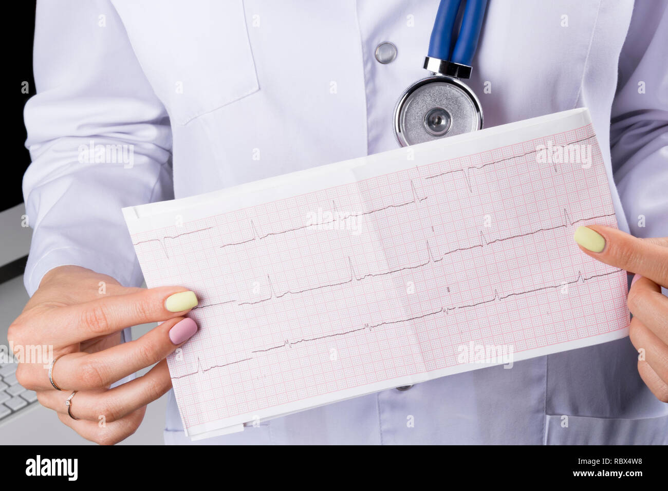 Electrocardiogram, ecg in hand of a female doctor. Medical health care ...
