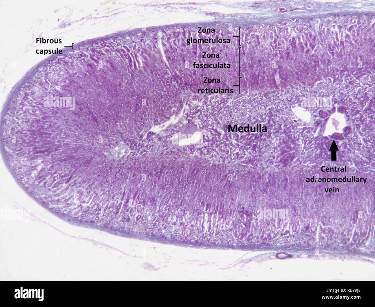 Adrenal cortex hi-res stock photography and images - Alamy