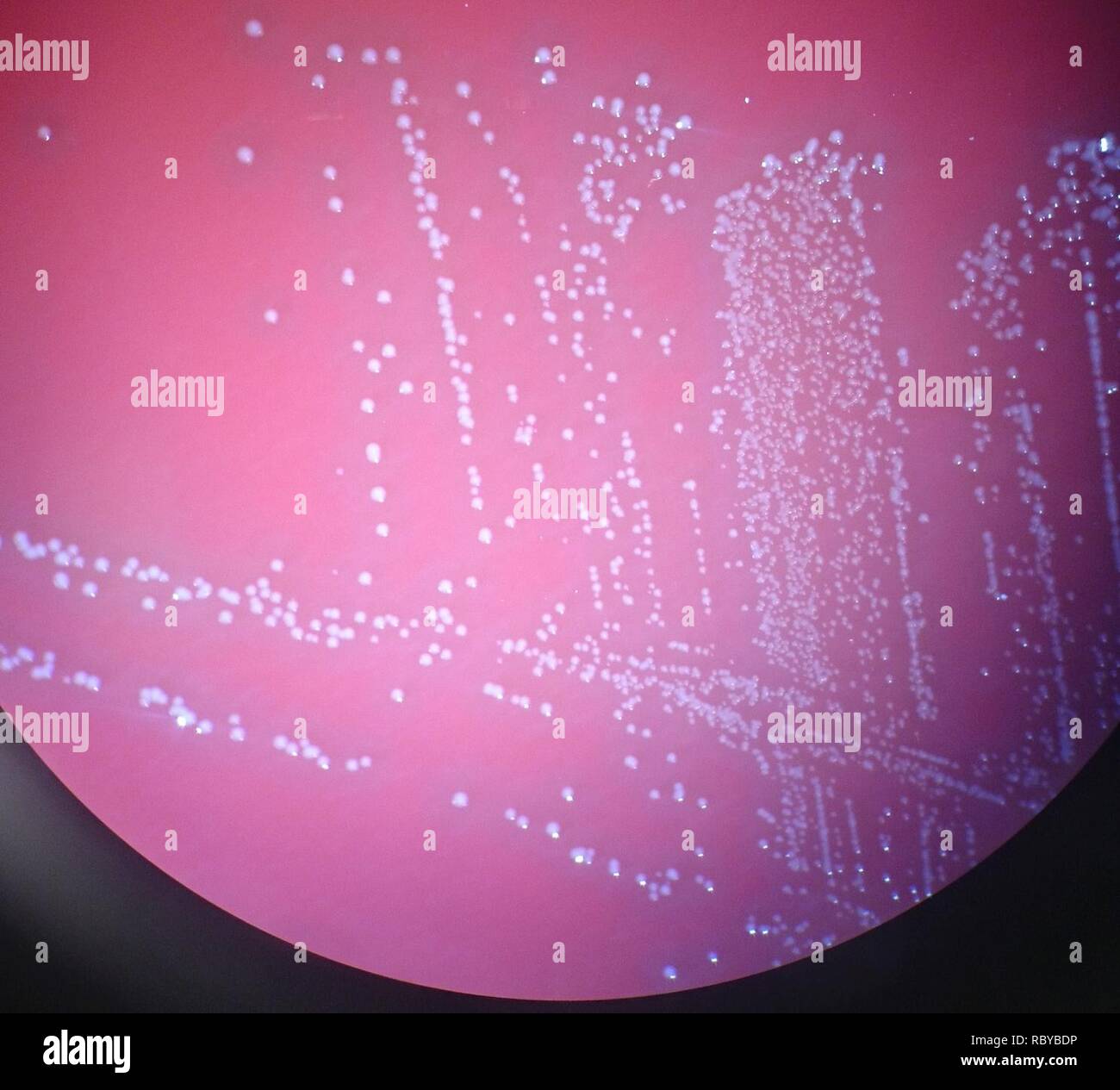 Aerococcus urinae - colonies Stock Photo - Alamy