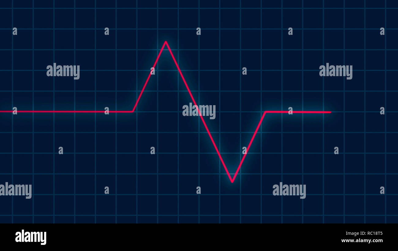 Red heartbeat pulse on cardiogram screen, cardio healthcare concept ...