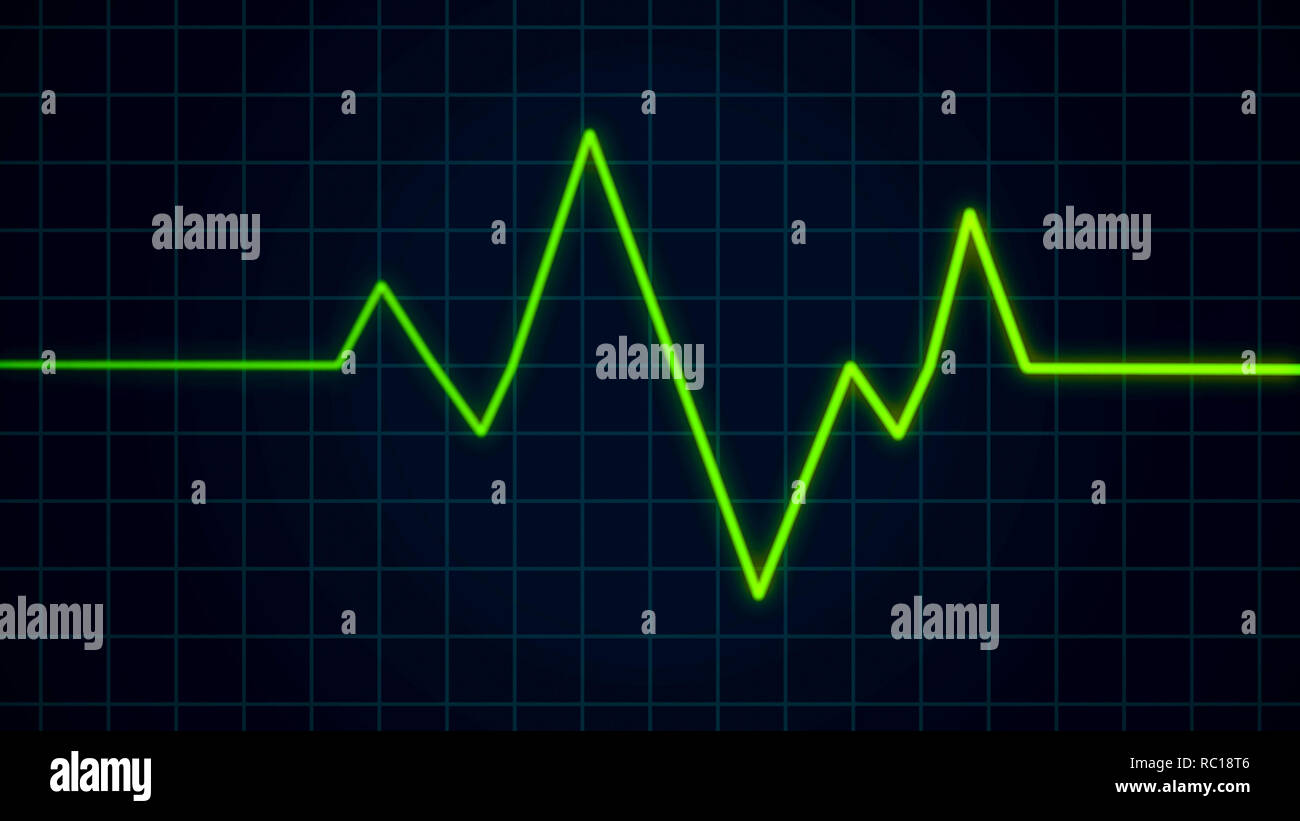 Green heartbeat pulse on cardiogram screen, EKG ECG cardio healthcare ...