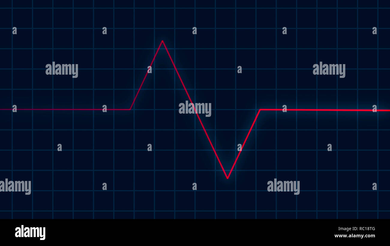 Red heartbeat pulse on cardiogram screen, cardio healthcare concept ...