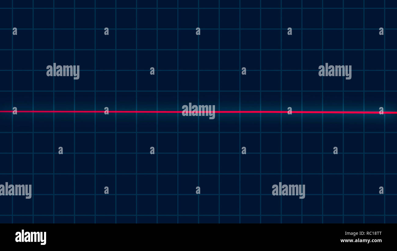 Red heartbeat pulse flatlines on cardiogram screen, cardio healthcare ...