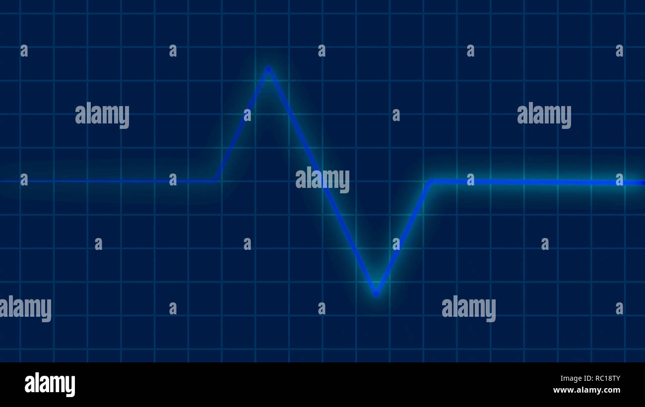 Blue heartbeat pulse on cardiogram screen, EKG ECG cardio healthcare ...