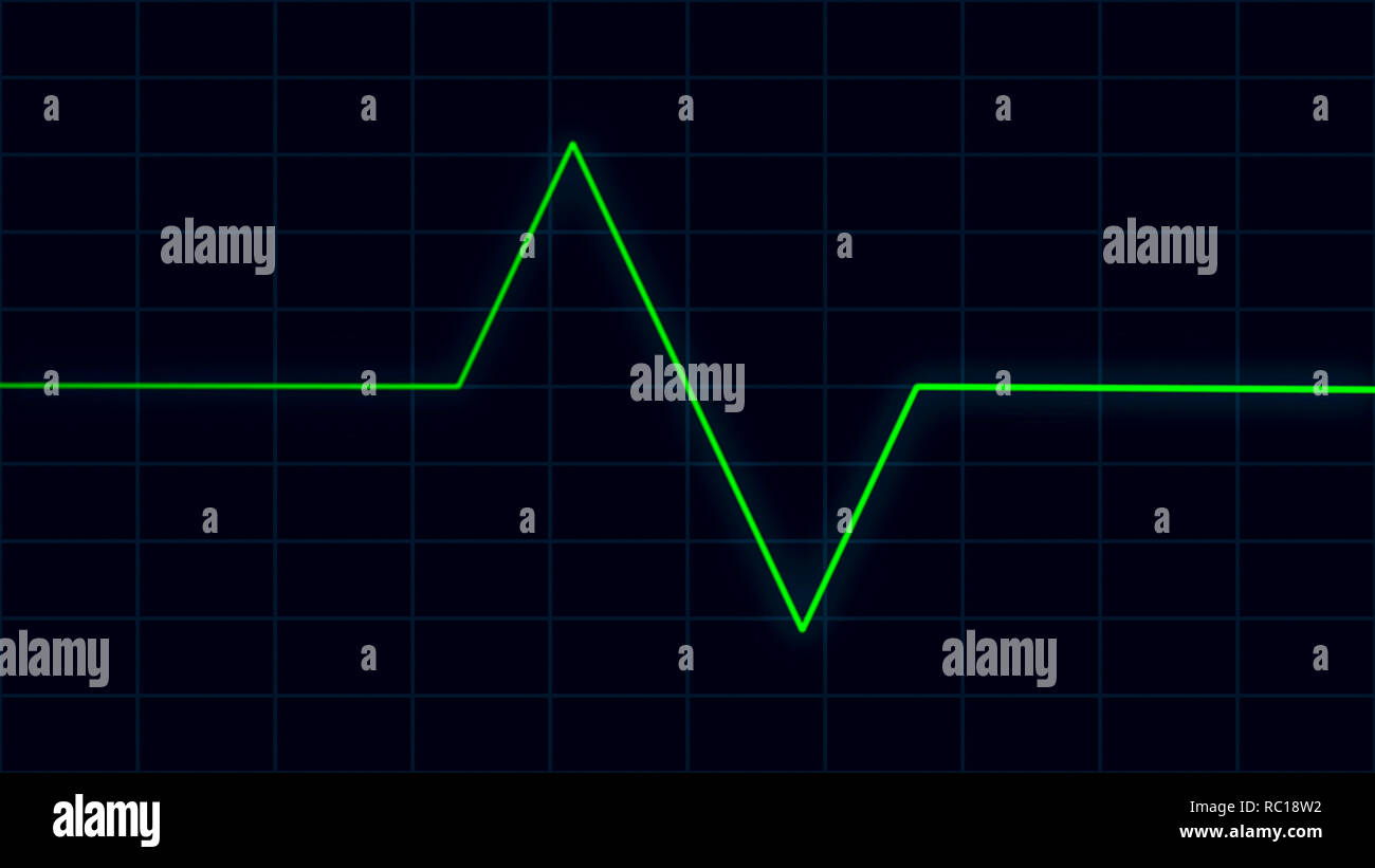 Green heartbeat pulse on cardiogram screen, EKG ECG cardio healthcare ...