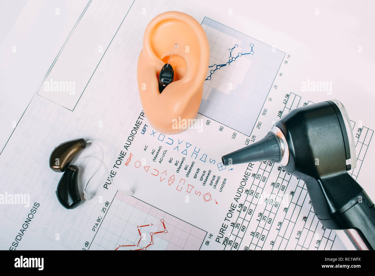 Hearing test concept. Result of hearing exam - audiogram, hearing aids ...