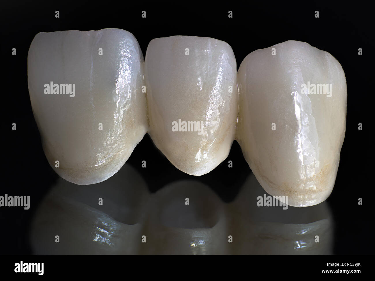 Zirconia teeth hi-res stock photography and images - Alamy