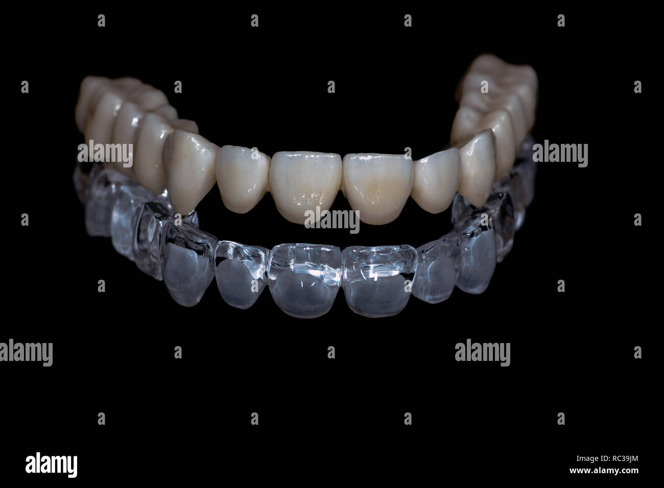 Ceramic zirconia teeth Stock Photo - Alamy