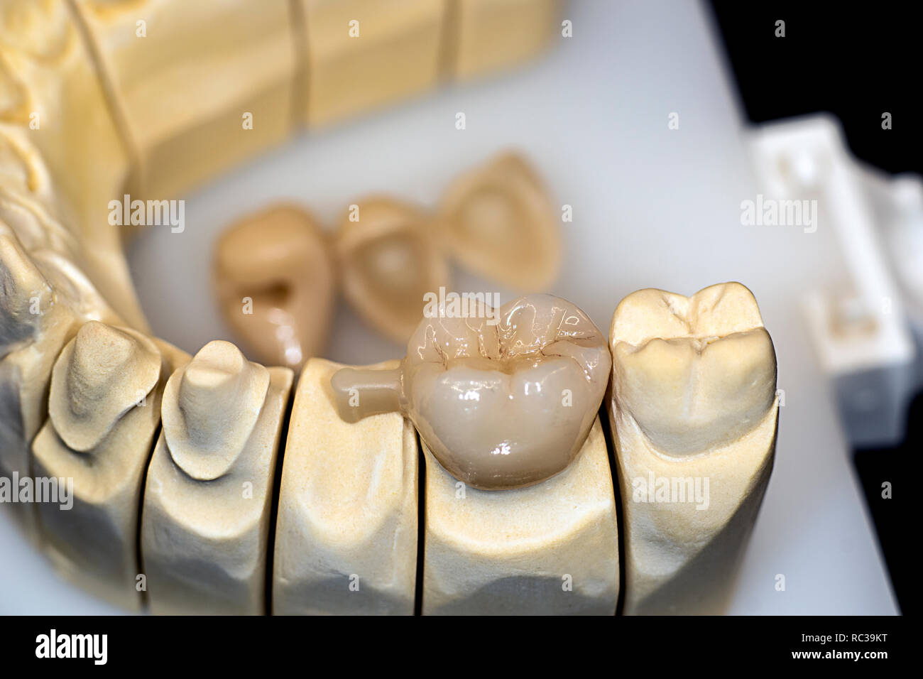 Ceramic zirconia teeth Stock Photo - Alamy