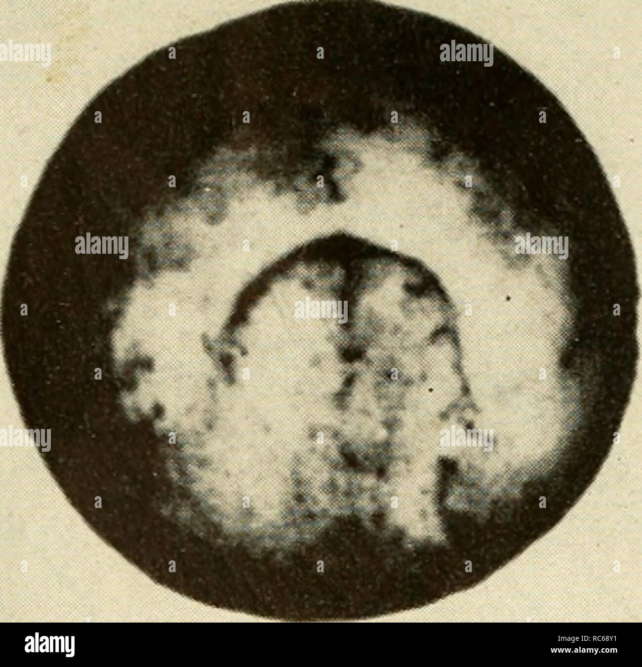 . Embryology. Embryology; Embryology; genealogy. REARRANGEMENT OF ...