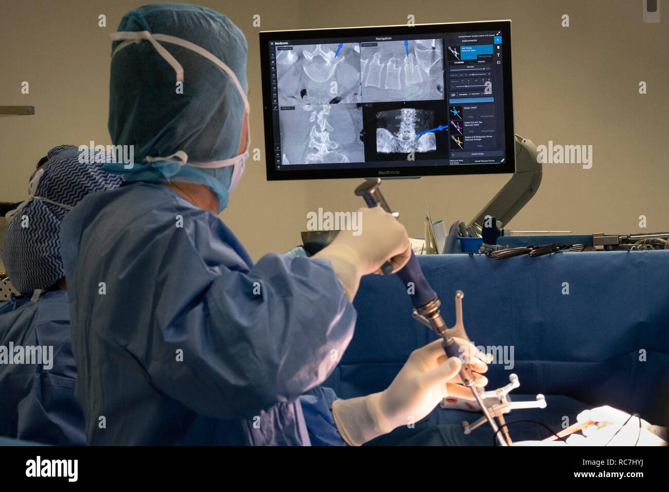 Doctor looking at the neuronavigation computer-assisted technology ...