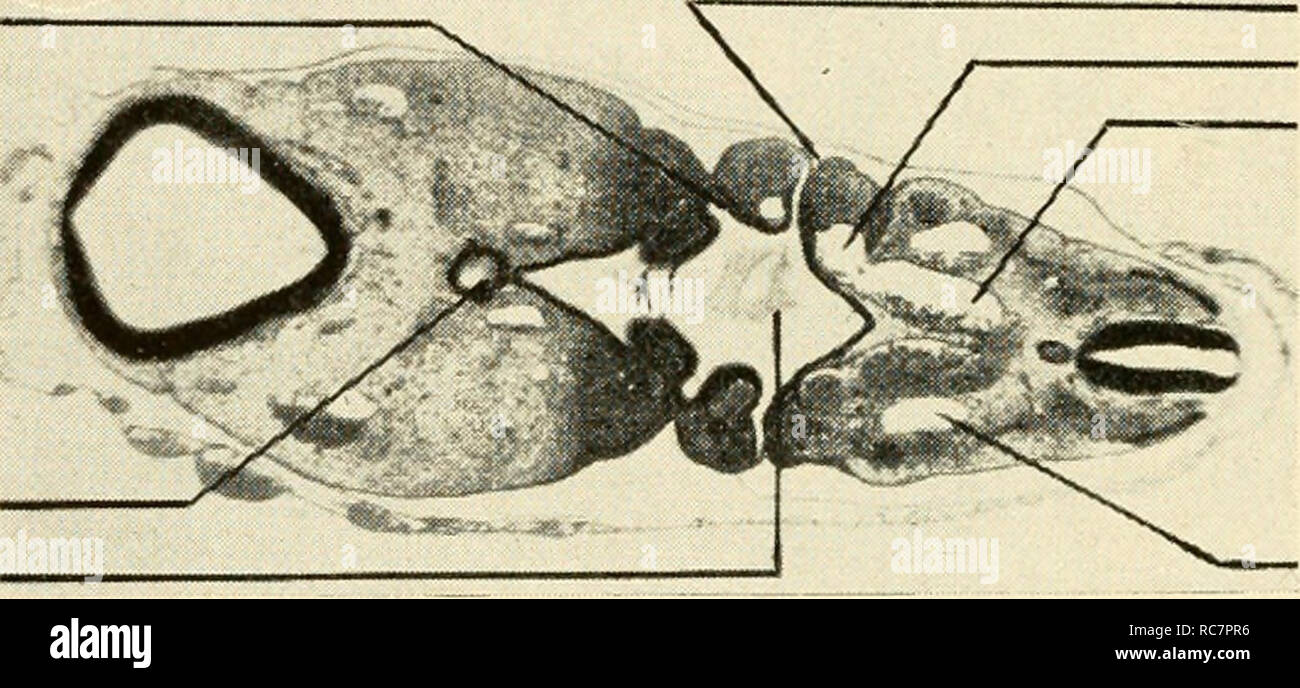 Metencephalon High Resolution Stock Photography and Images - Alamy