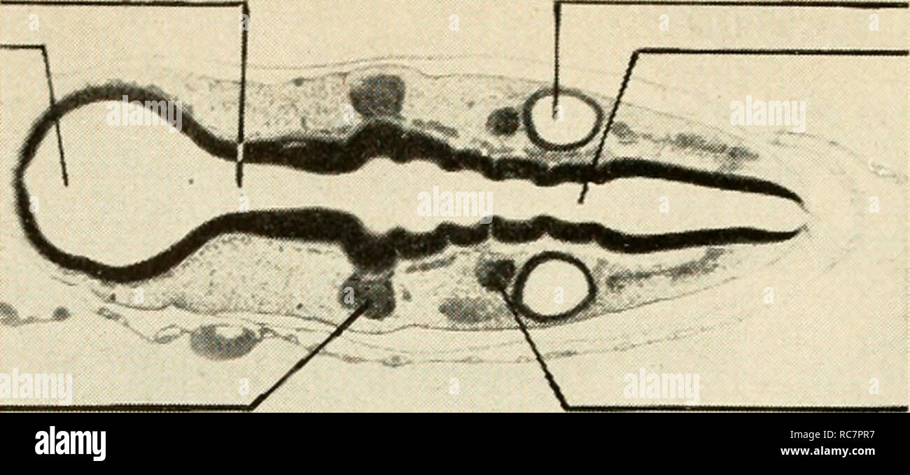 Metencephalon High Resolution Stock Photography and Images - Alamy