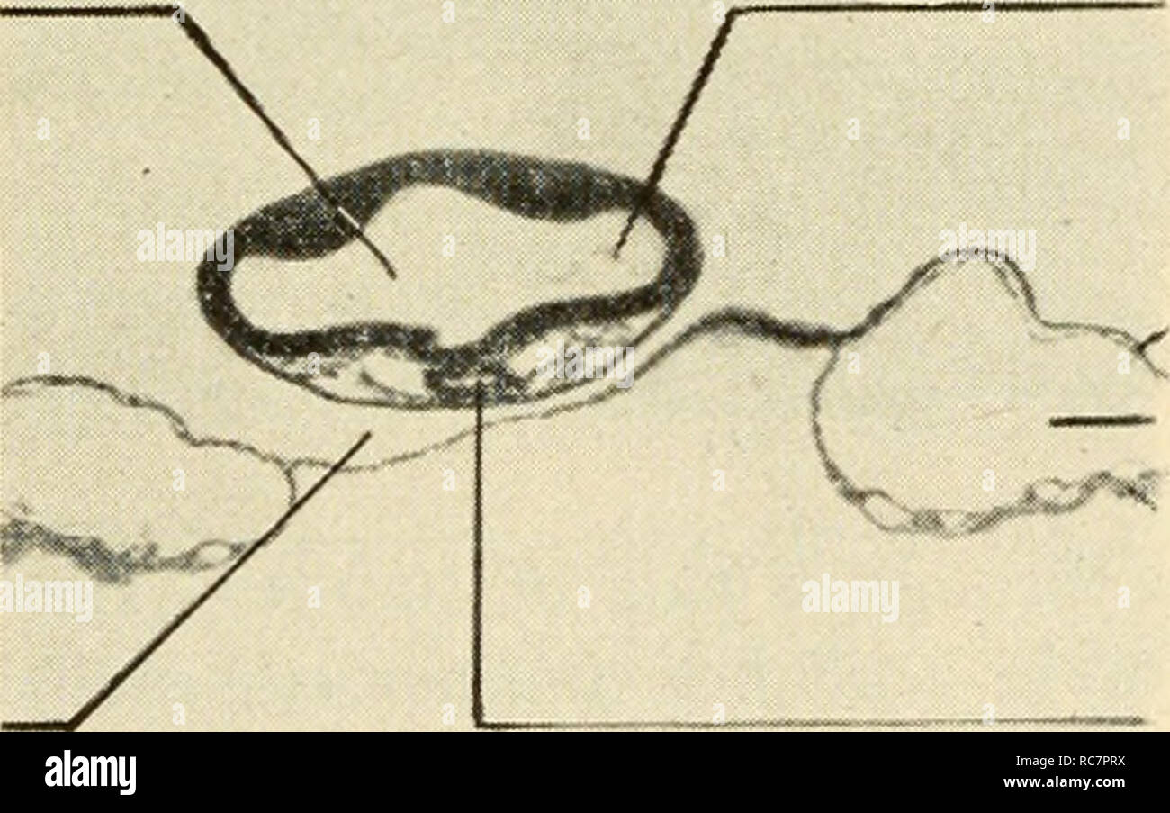. Embryology. Embryology; Embryology; genealogy. OPTIC VESICLE ...