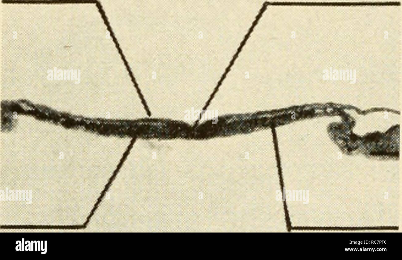 . Embryology. Embryology; Embryology; genealogy. SOMATOPLEURE ...