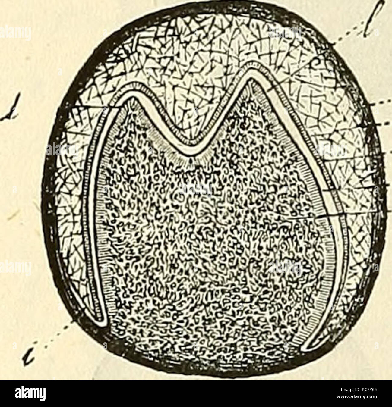 Pulpe dentaire hi-res stock photography and images - Alamy