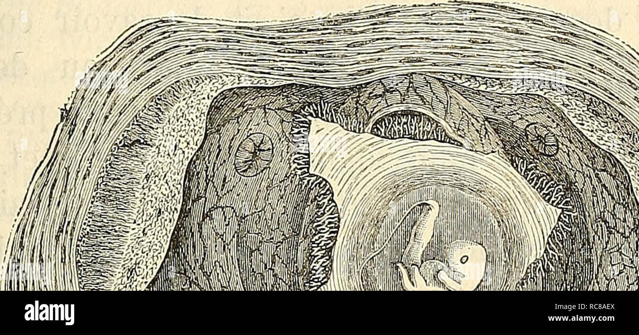 Placenta humain hi-res stock photography and images - Alamy