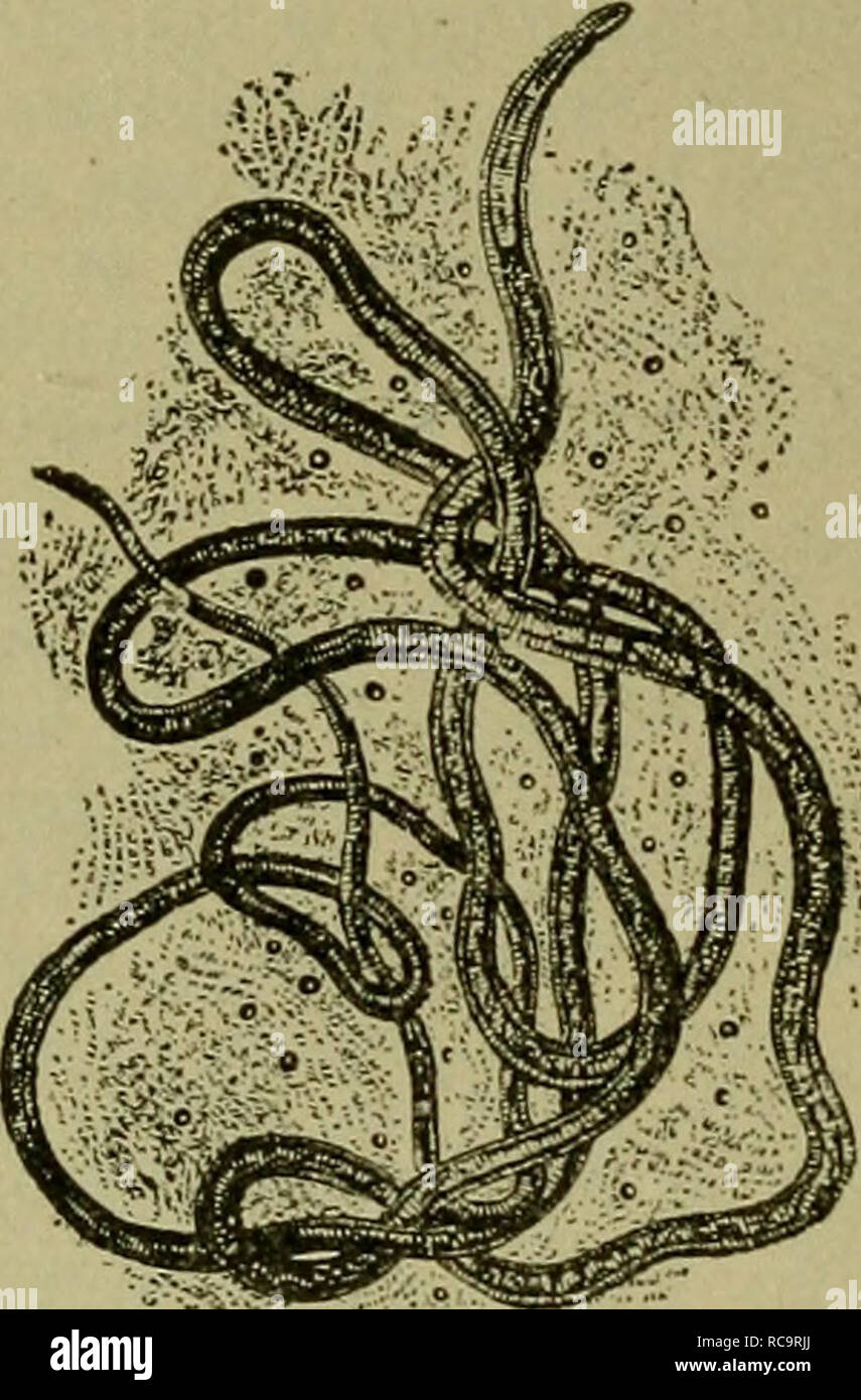 Filaria worm hi-res stock photography and images - Alamy