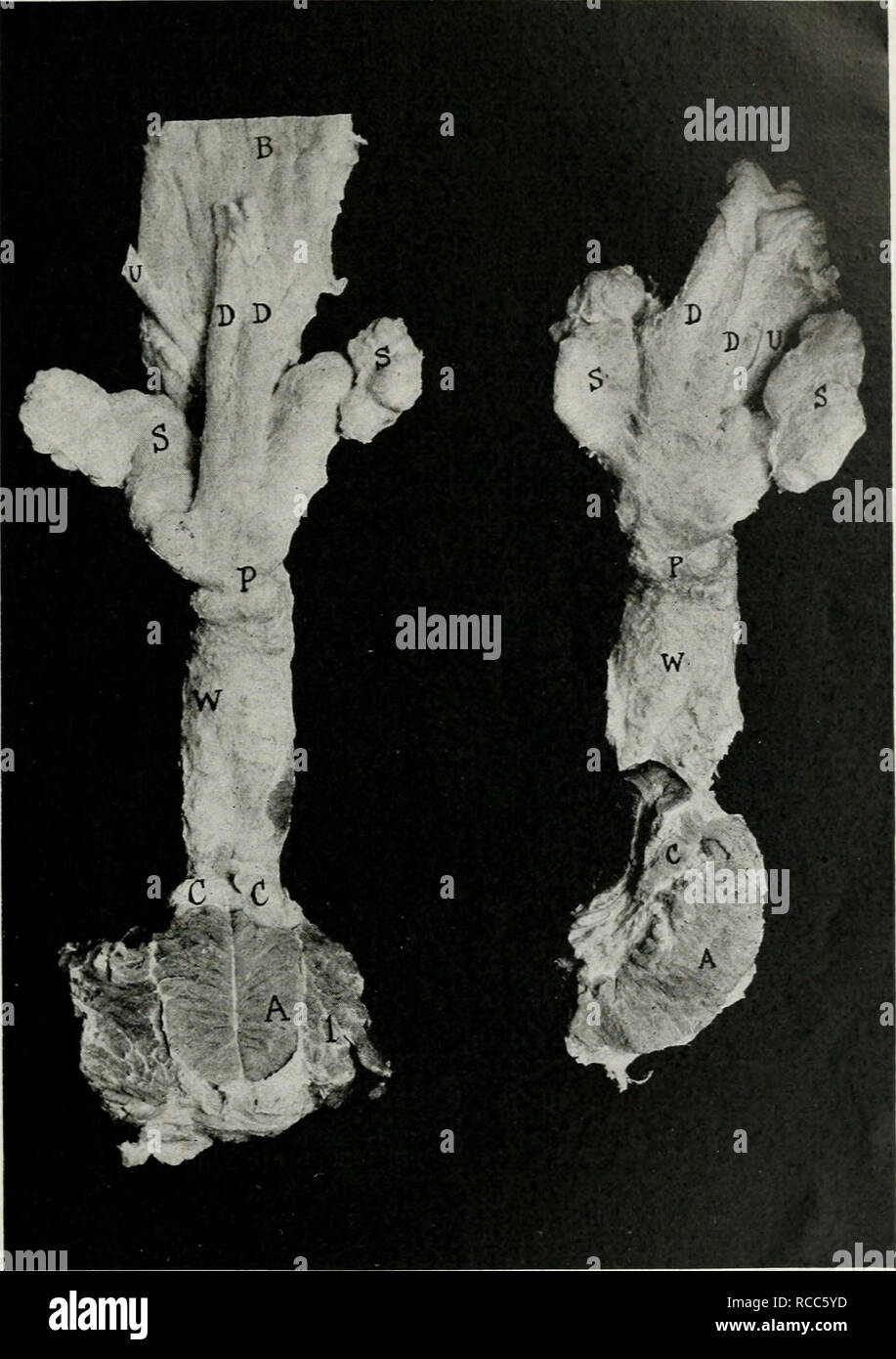 Urethra male female hi-res stock photography and images - Alamy