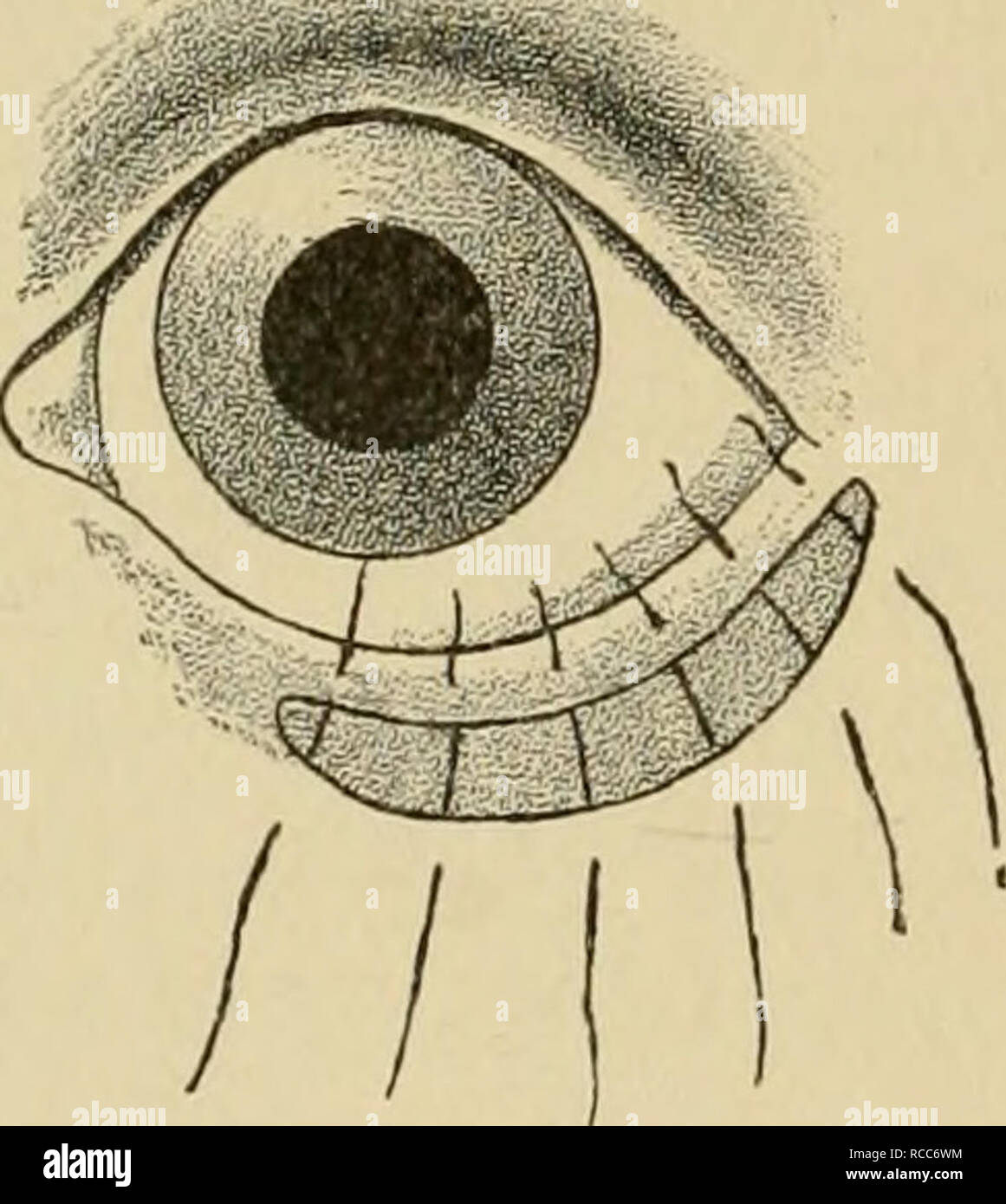 Puncturing the skin hi-res stock photography and images - Alamy