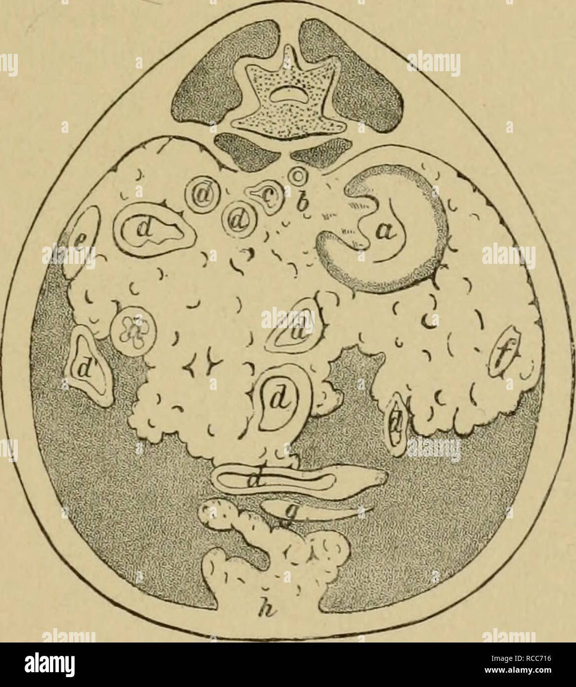 Treatment of dropsy hi-res stock photography and images - Alamy